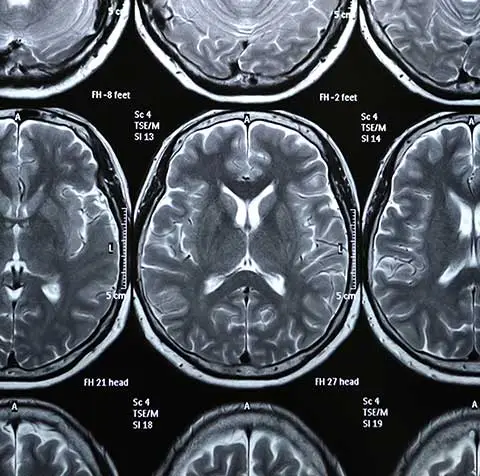 Imagerie par Résonance Magnétique | Bracco